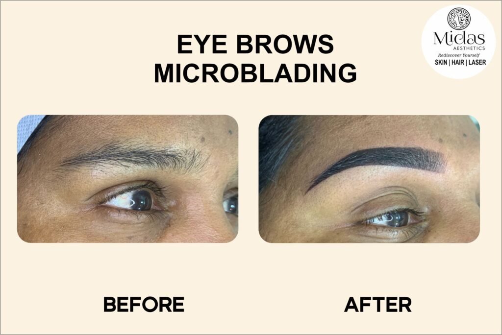 The Art of Perfect Brows: Enhancing Your Look with Microblading - Midas ...
