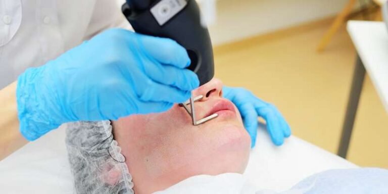 How to Choose the Right Acne Scar Removal Treatment for Your Skin Type ...