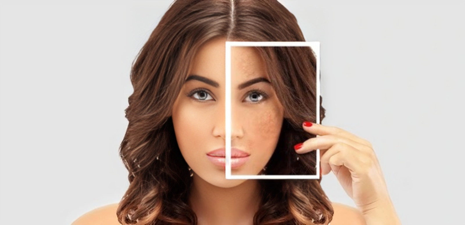 Comprehensive Guide to Pigmentation: Causes, Symptoms, and Effective ...