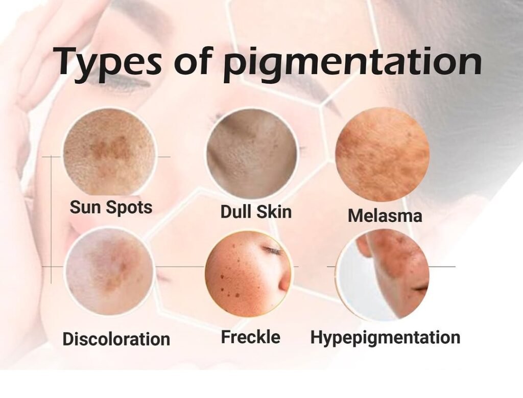 Vitamin C and Pigmentation: Why doesn't it work for you? - Midas ...